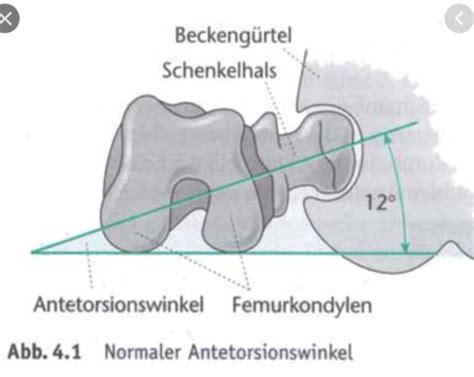 Kinder H Fte Wirbels Ule Flashcards Quizlet