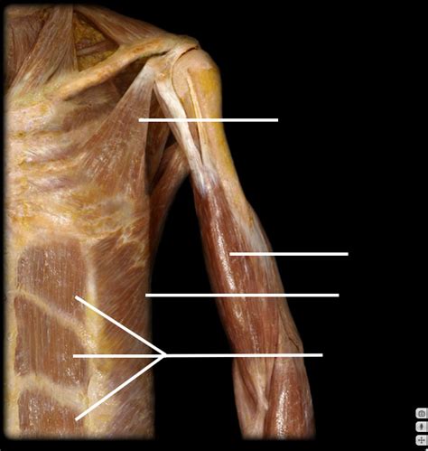 Anterior Deep Muscles Of The Upper Limbs And Shoulder Diagram Quizlet