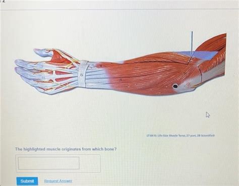 Solved The Highlighted Muscle Originates From Which Bone