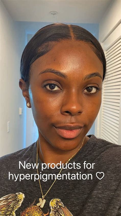 How To Get Clear Skin Get Rid Of Hyperpigmentation Skin Care
