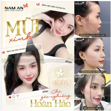 GÓC NGHIÊNG HOÀN HẢO TỰ TIN TỎA SÁNG