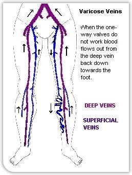 Diagram Of Veins In The Leg