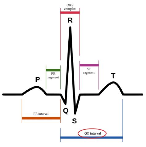 Qt Interval In Normal Echocardiogram Courtesy Of Wikimedia Commons