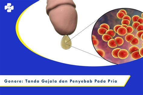 Gonore Tanda Gejala Dan Penyebab Pada Pria