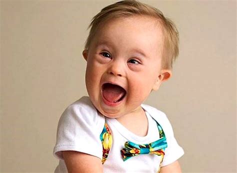 Todo lo que debes saber sobre bebés con síndrome de Down Noticias