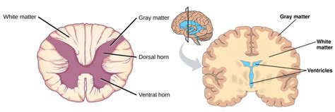 Neurosono