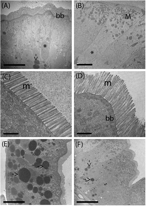 Transmission Electron Microscopy Tem Shows The Ultrastructure Of The