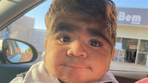 Bebê que nasceu barba faz sucesso nas redes sociais e pai explica