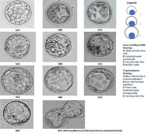 Guide To Ivf Lab Results Embryo Grading System Faqs Pacific Centre