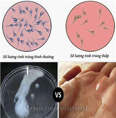Mỗi lần xuất tinh bao nhiêu tinh trùng bao nhiêu ml màu sắc như thế nào