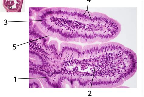 Duodenum Histology Diagram Quizlet
