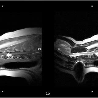 A T1 Weighted Spin Echo Sequence Image In Sagittal Plane B