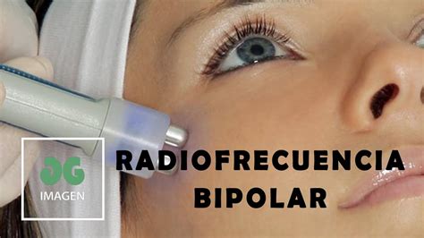 Beneficios De La Radiofrecuencia Bipolar Youtube