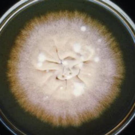 Bacto Final Spirochetes Fungi Flashcards Quizlet