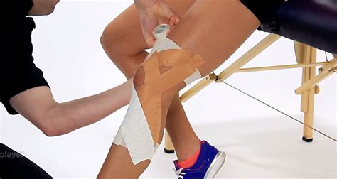 MCL Sprain Symptoms Treatment Exercises Rehabilitation