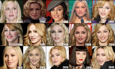 Madonna Lifting Viso Rifatti Chirurgia Estetica Vip