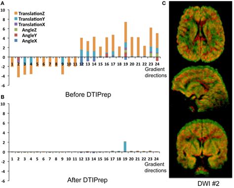 head motion artifacts rigid registration parameters between each download scientific diagram