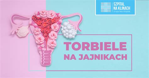 Torbiele na jajnikach czym są jakie dają objawy i jak się je leczy