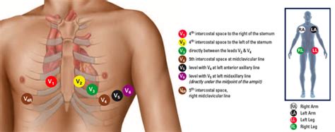 12 Lead EKG Flashcards Quizlet