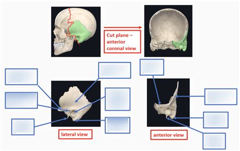 Temporal Bone Diagram Quizlet
