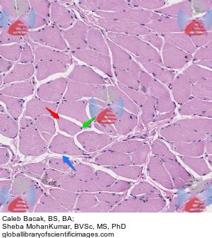 Cardiac Muscle Histology Cross Section