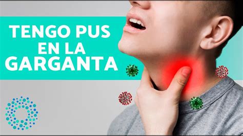 Por Qué Sale PUS en la GARGANTA Infección en Garganta con Pus