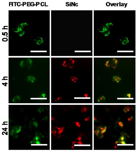 Representative Fluorescence Microscopy Images Of A2780 CDDP Ovarian