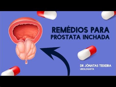 PRÓSTATA INCHADA Tratamento remédio para hiperplasia prostática