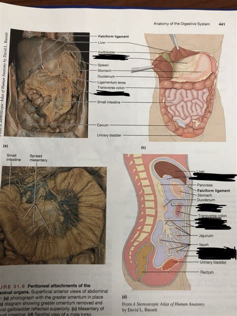 Peritoneum Diagram Quizlet