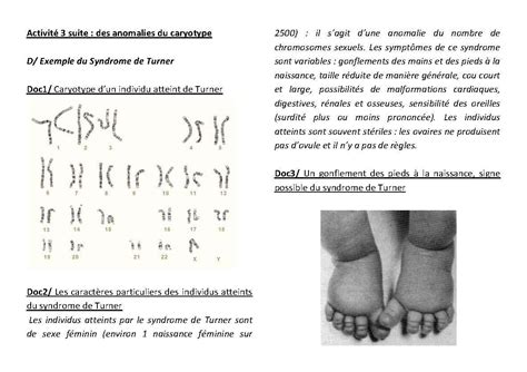 Bonjour SVT 3ème Docs A à D On parle danomalie chromosomique