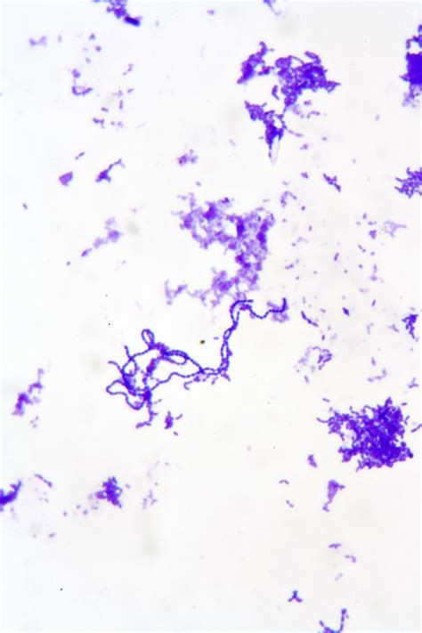 Streptococcus Pneumoniae Bacteria Lm Photograph By Science Stock