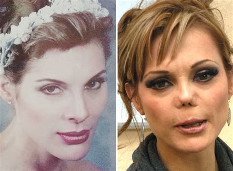 Antes y después Carmen Campuzano y otras famosas con cirugías faciales