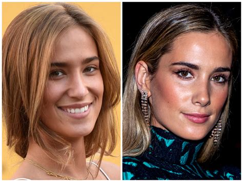 Antes y después de las famosas que se han operado la nariz