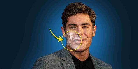 Zac Efron dice que casi muere y explica qué le pasó a su cara