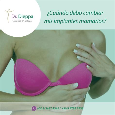 Cuándo debes cambiar tus implantes mamarios