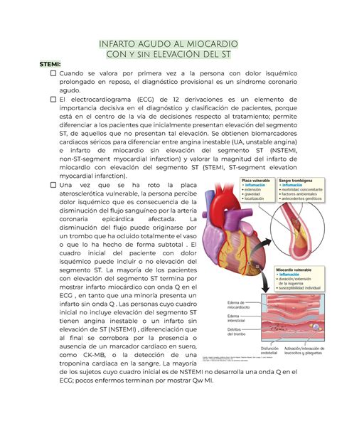 Infarto Agudo Al Miocardio Resumen Infarto Agudo Al Miocardio Con Y