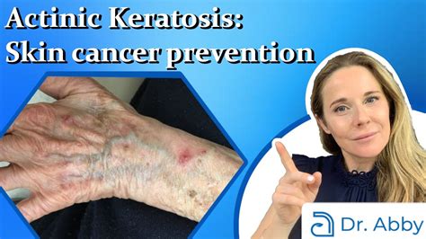 University Dermatology Center Medicalmonday A List Of 55 OFF
