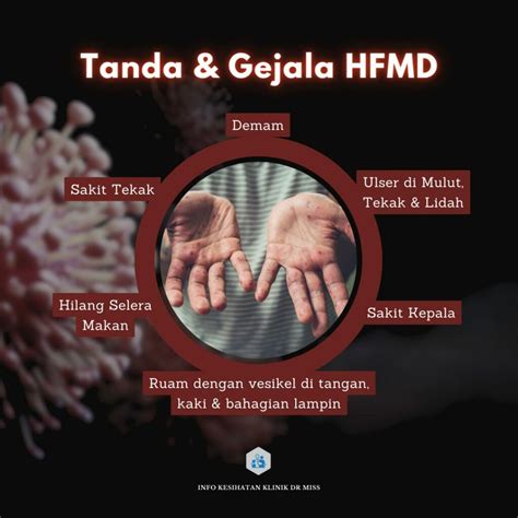 Penyakit Tangan Kaki Dan Mulut HFMD Bagaimana Cara Untuk Mengelak