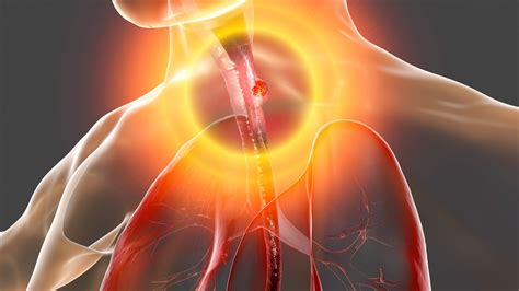Preliminary Study Shows Minimally Invasive Diagnostic Biomarker