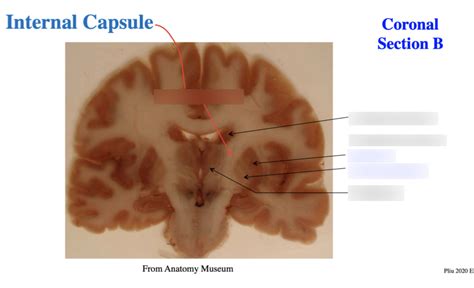 Basal Nuclei Diagram Quizlet