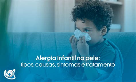 Alergia Infantil Na Pele Tipos Causas Sintomas E Tratamento