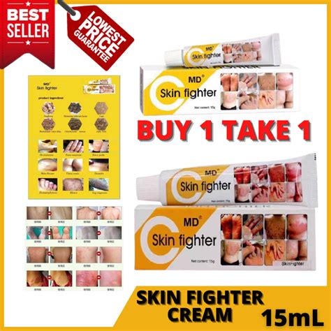BUY 1 TAKE 1 100 Original MD Skin Fighter Cream For Skin Allergies Or