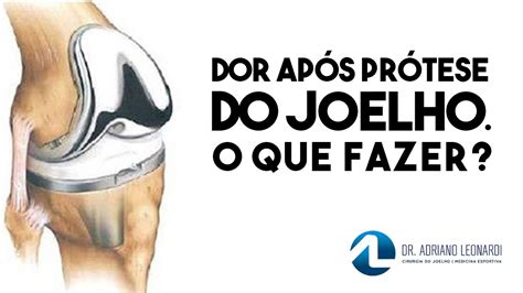 Recuperação após PRÓTESE DO JOELHO Tratamento Artroscopia YouTube
