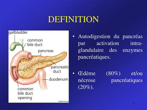 Ppt Pancreatite Aigue Approche Diagnostique Powerpoint Presentation