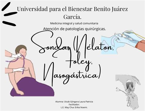 Sondas de Nelatón Sonda de Foley y Sonda Nasogástrica de Levin