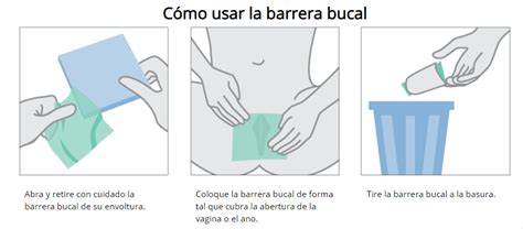 Apoyarse Menos Pack Para Poner Que Son Las Barreras De Latex Bucales
