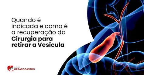 Quando é Indicada E Como é A Recuperação Da Cirurgia Para Retirar A