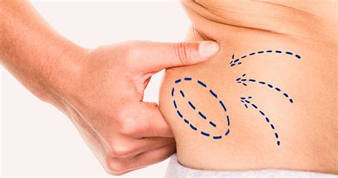 Tipos de grasa en tu cuerpo Cuál es saludable y cuál no