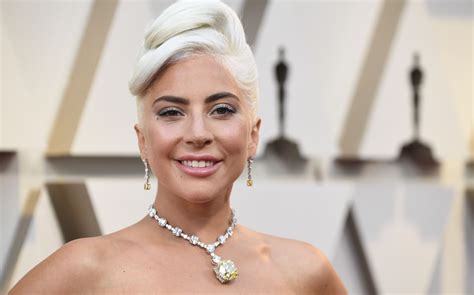 Lady Gaga y el accidente que la llevó al quirófano qué pasó CHIC
