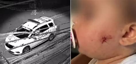 Policial Militar atira em rosto de criança de 1 ano arma de airsoft